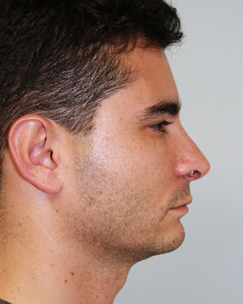 Perfect Male Nose Side View