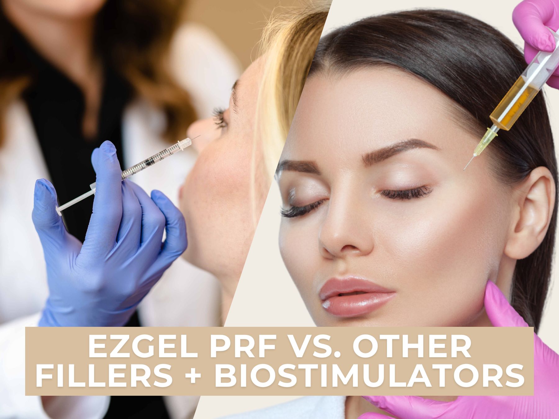 EZGel PRF vs. Other Fillers and Biostimulators: Unveiling the Right ...