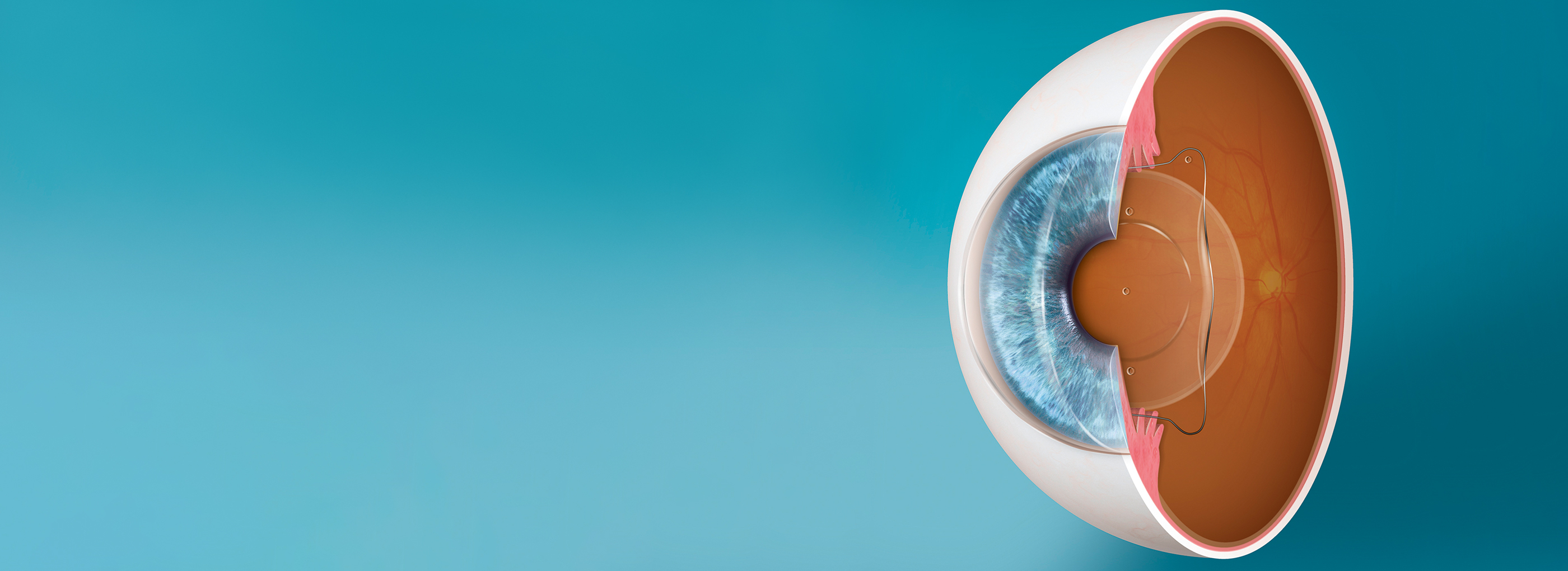 Custom Vision Correction | Coastal Eye