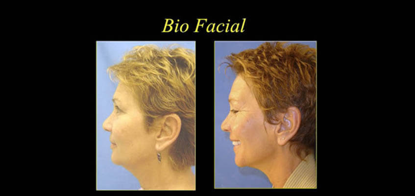 Bio Facial Skin Rejuvenation - Greco Hair Restoration