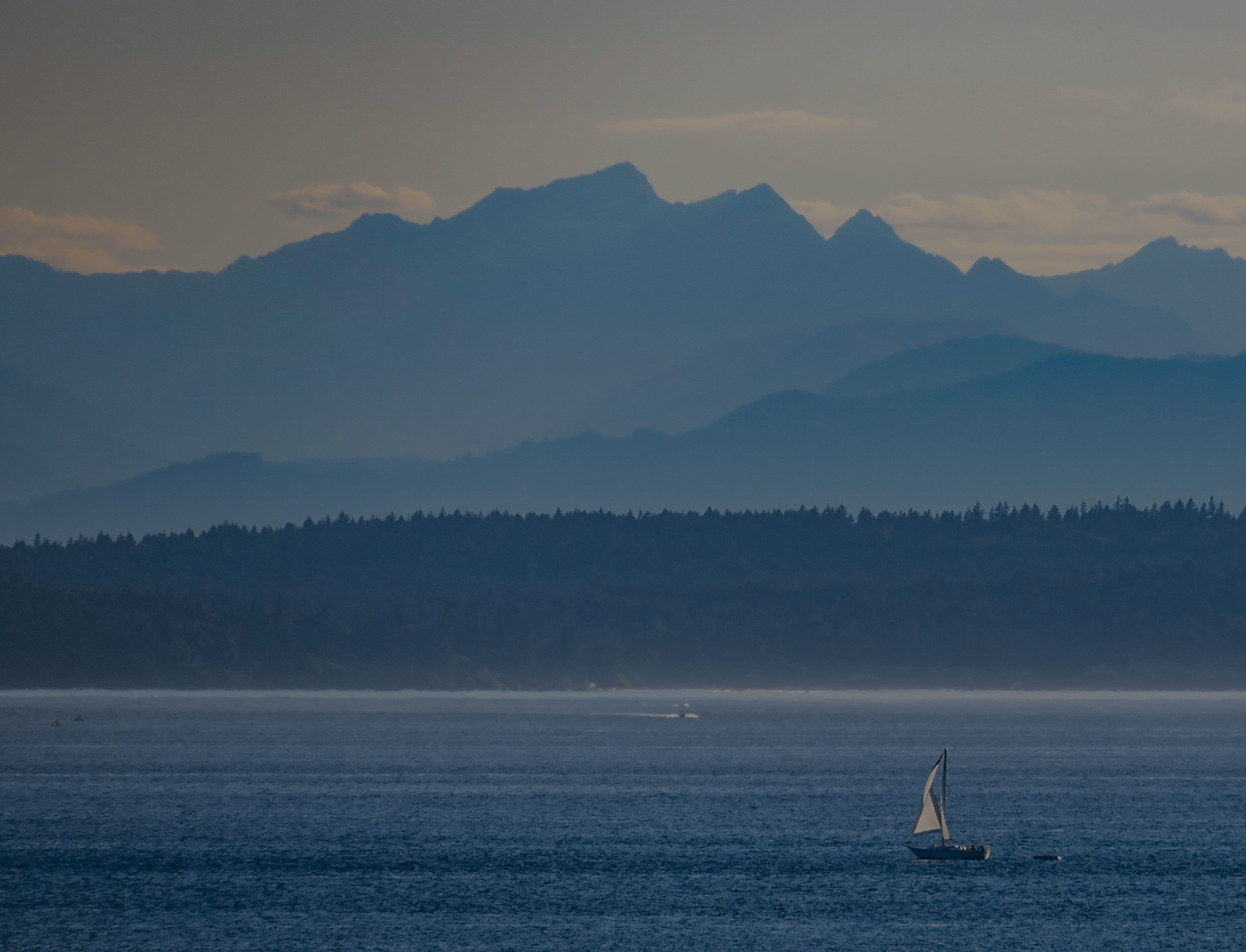 Neck Lift Bellevue | Neck Lift Seattle | Bellevue Neck Lift