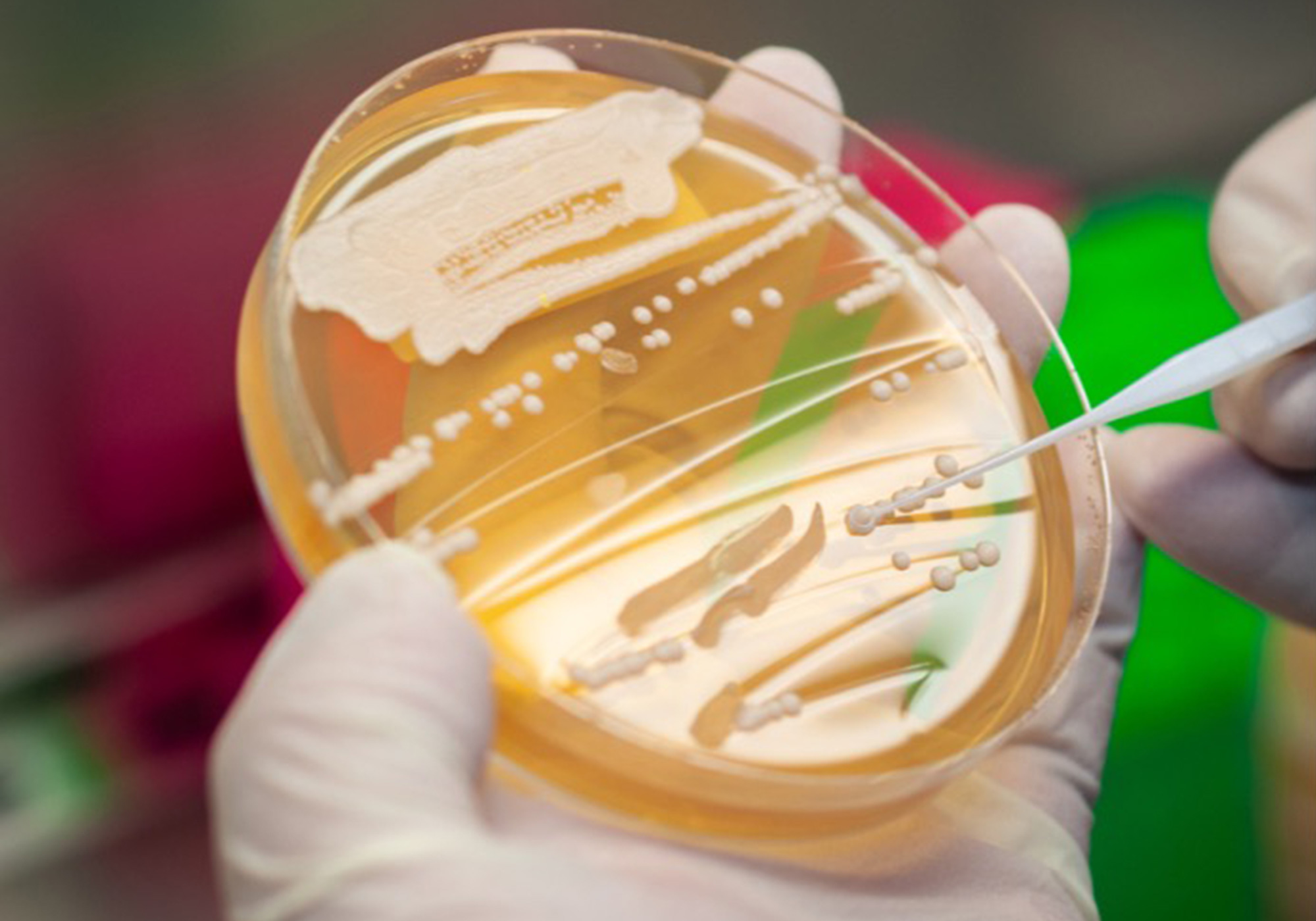 Unlocking the Benefits of Brewer’s Yeast in Distilling | Spirits ...