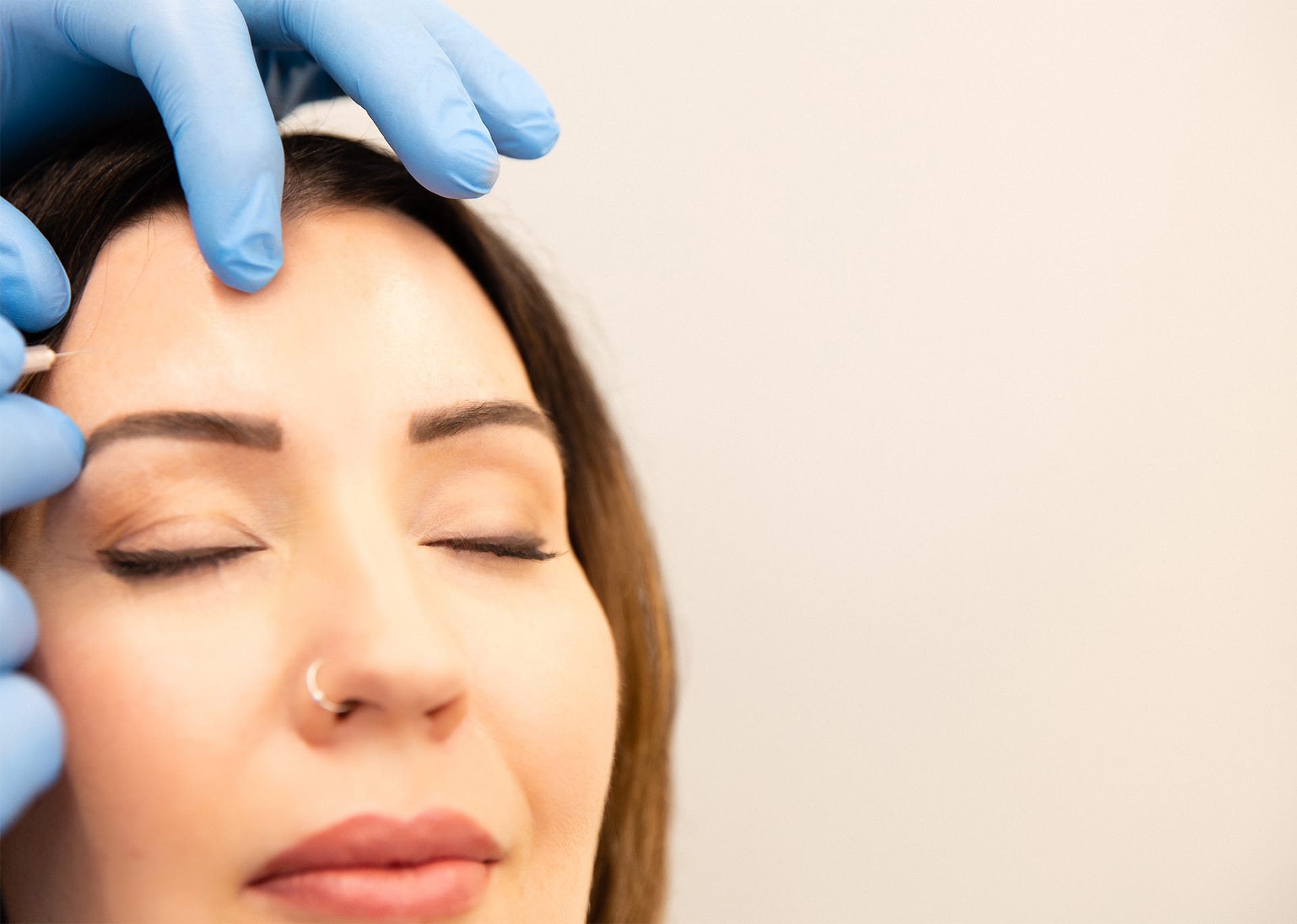 Forehead Lowering Guelph, ON | Forehead Lowering Kitchener