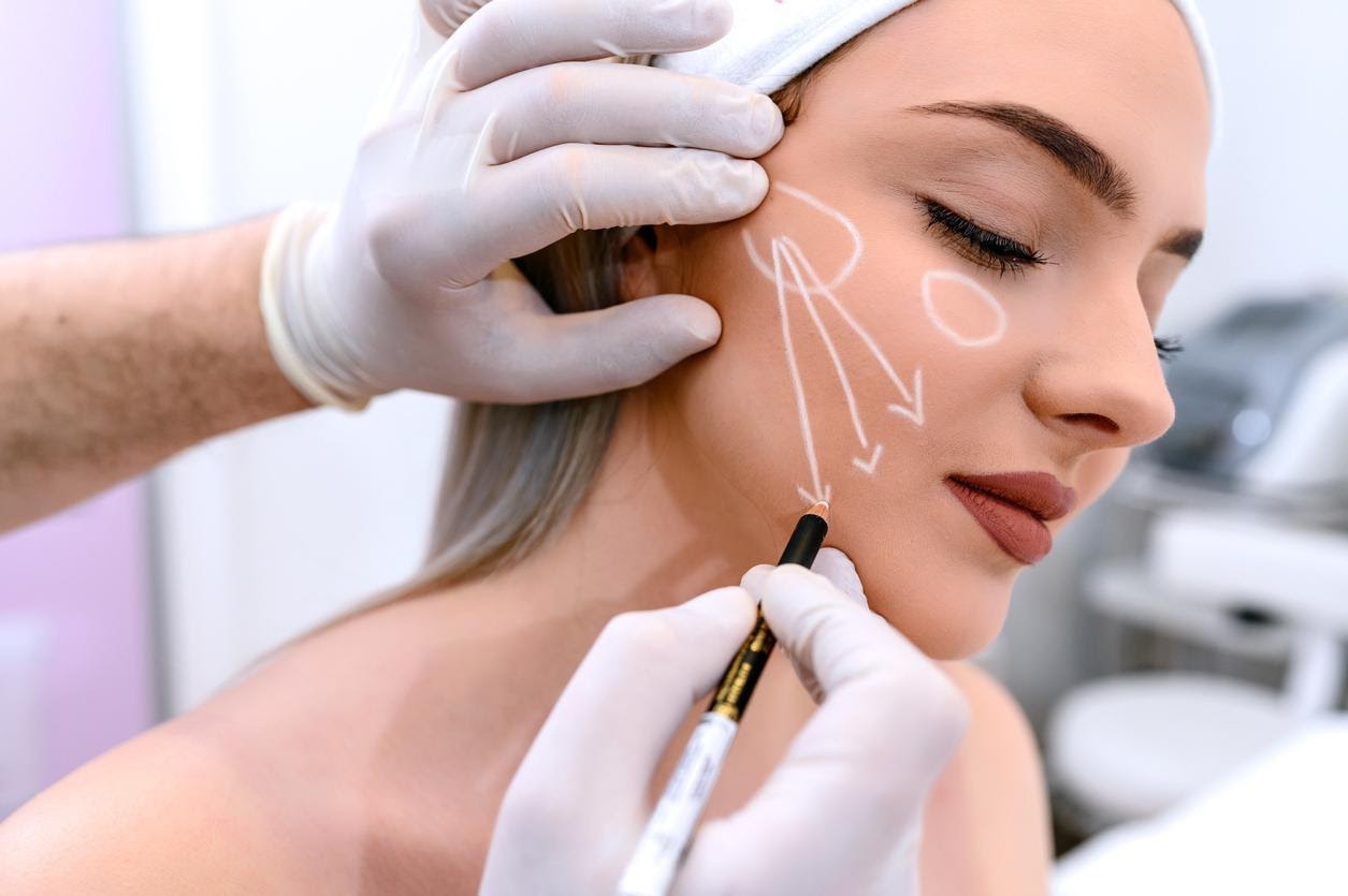 Everything You Need to Know About the Different Types of Facelifts ...