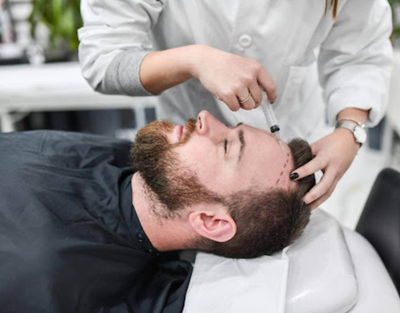 Are You A Good Candidate For A Hair Transplant Sarmela Sunder Md
