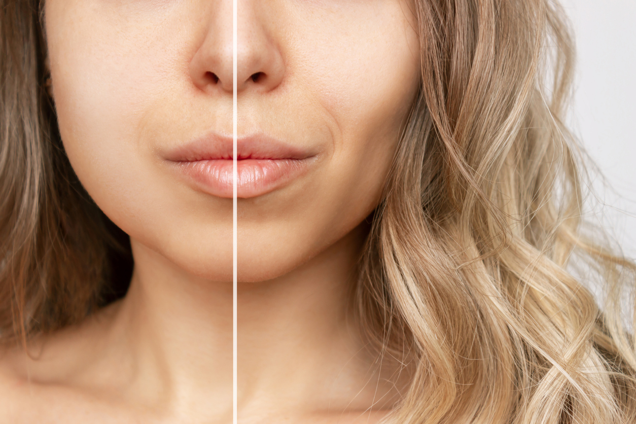 The Secret to Successful Face Fat Transfer Surgery | Sarmela Sunder, MD