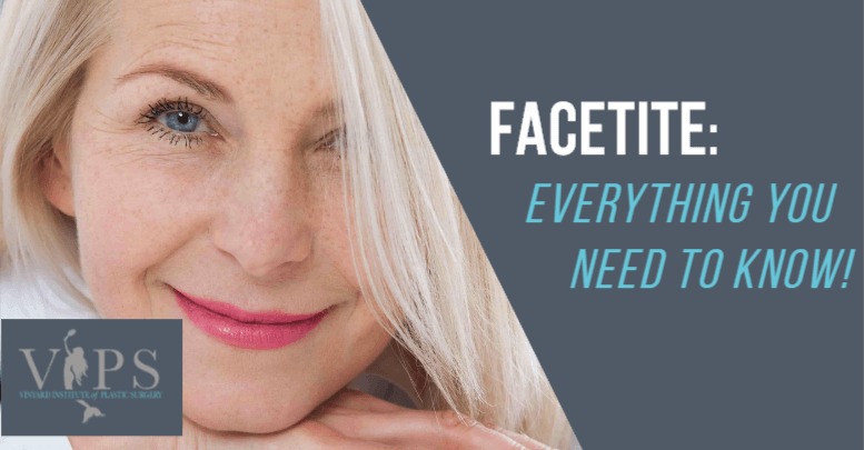 FaceTite - Everything You Need to Know About the 'Natural Facelift'