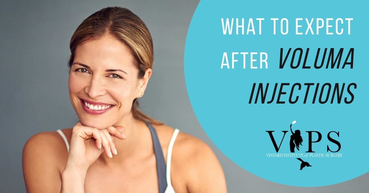 What Should I Expect After Juvederm Voluma XC Injections?