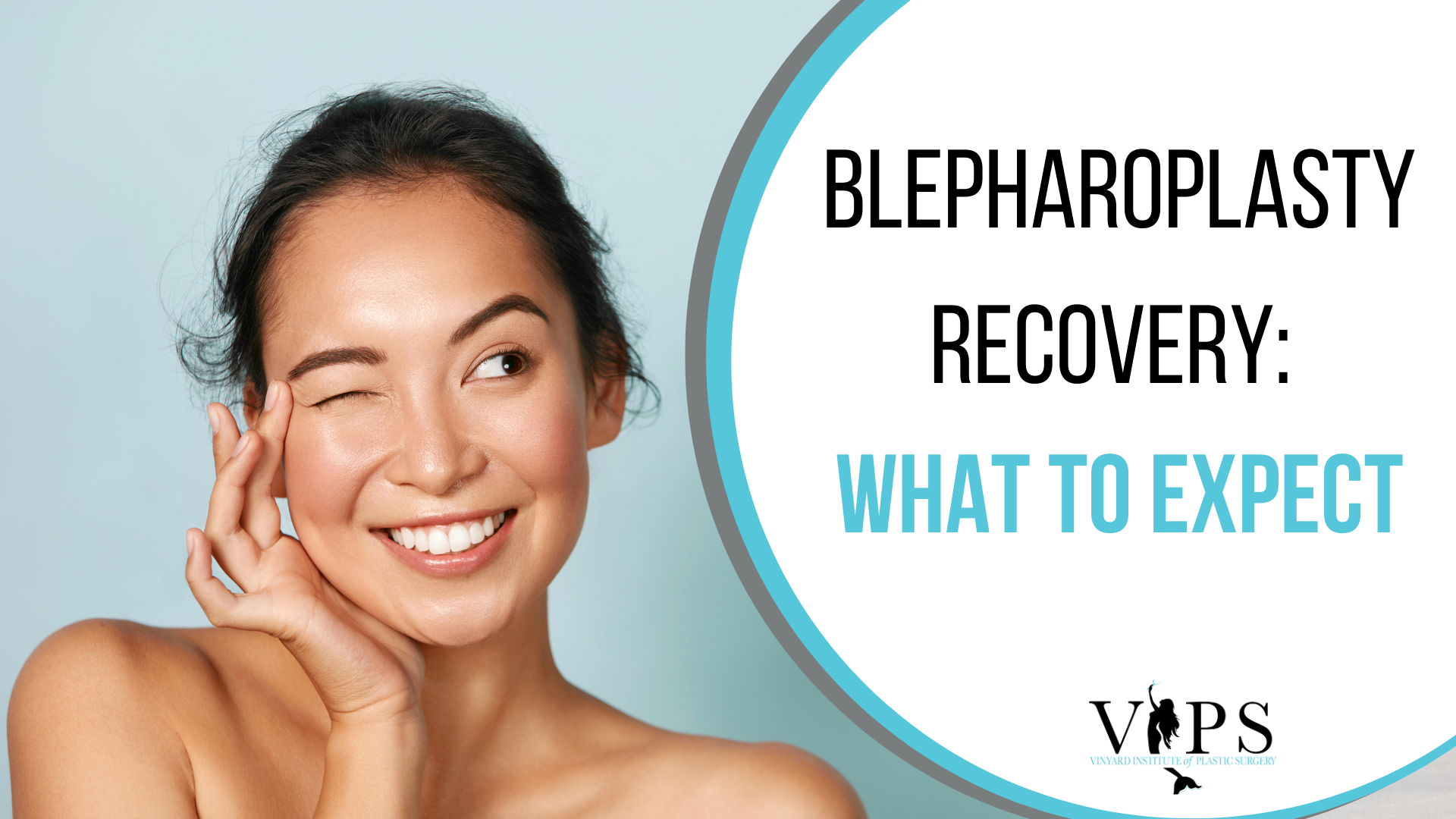 Blepharoplasty Recovery: What To Expect