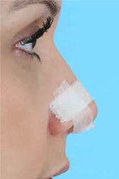 How to Tape the Nose After Rhinoplasty | Dr. Shah