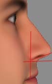 Nasolabial angle | Dr. Anil Shah, MD, FACS