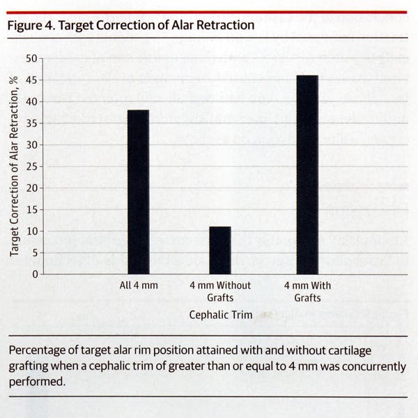 Alar Retraction: Treatment, and Prevention