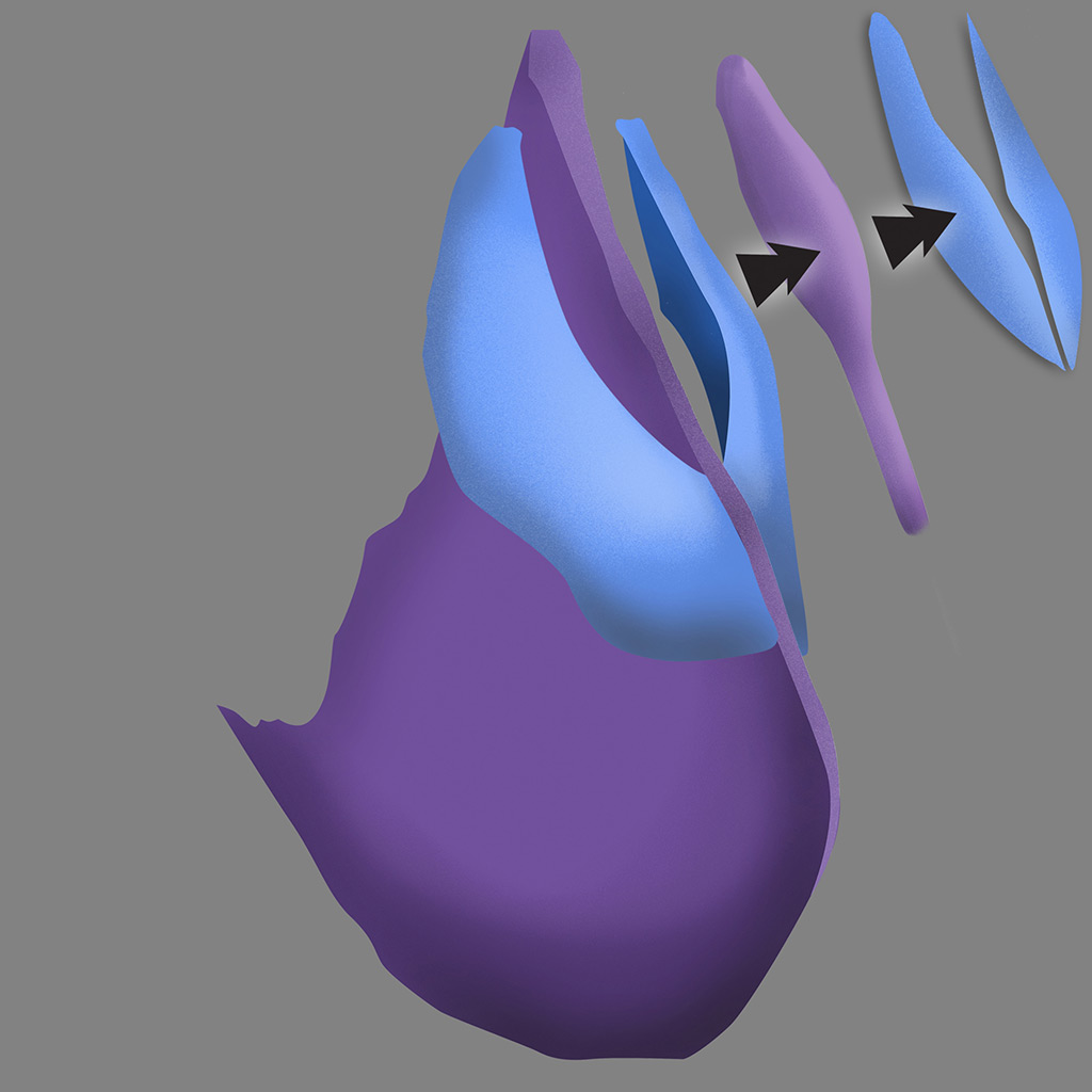 Dorsal Hump Removal | Chicago, IL | Dr. Anil Shah