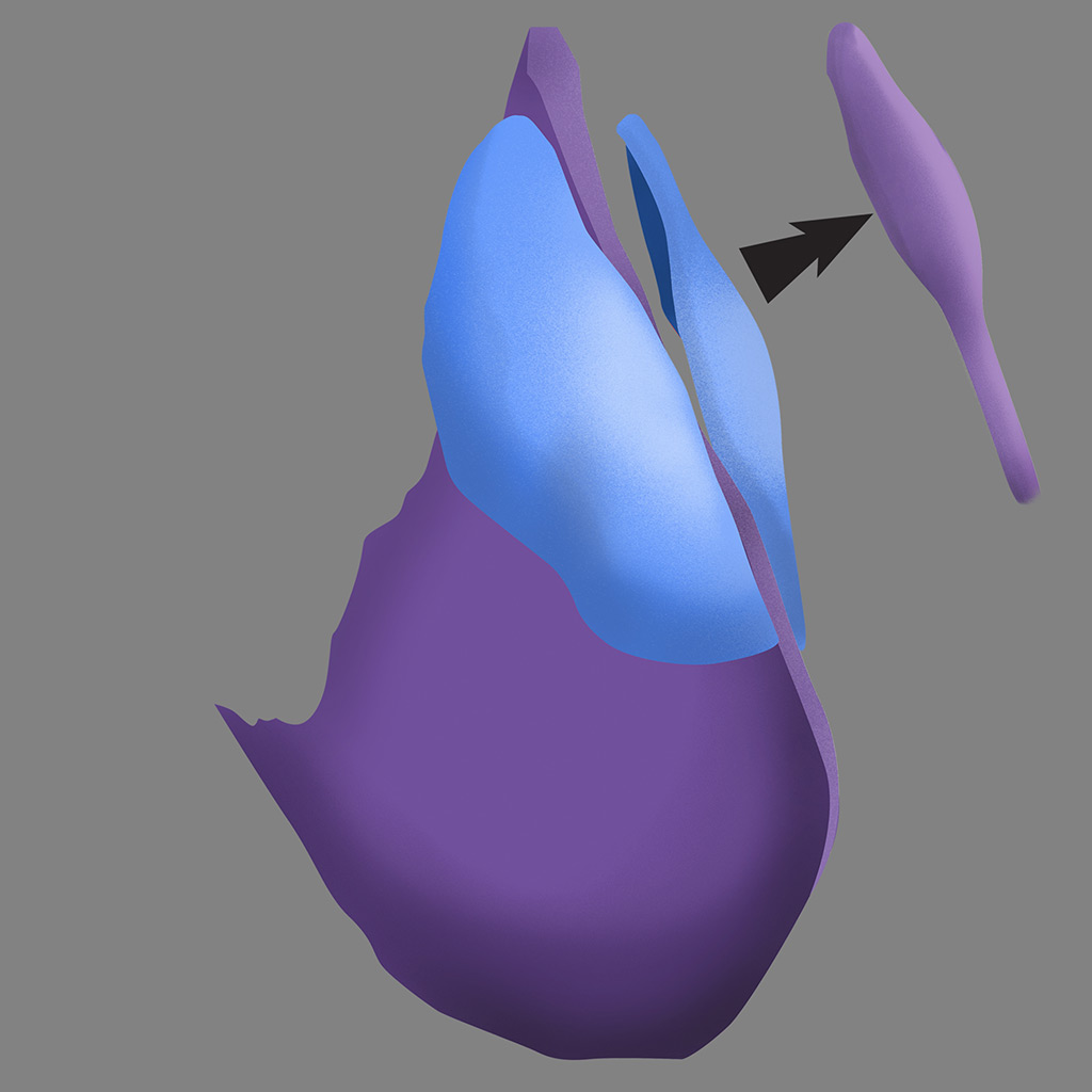 Dorsal Hump Removal | Chicago, IL | Dr. Anil Shah