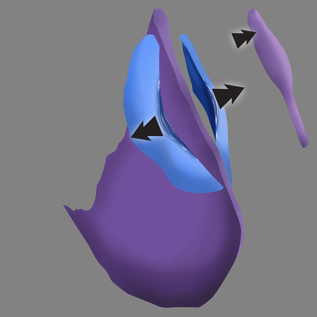 Dorsal Hump Removal | Chicago, IL | Dr. Anil Shah