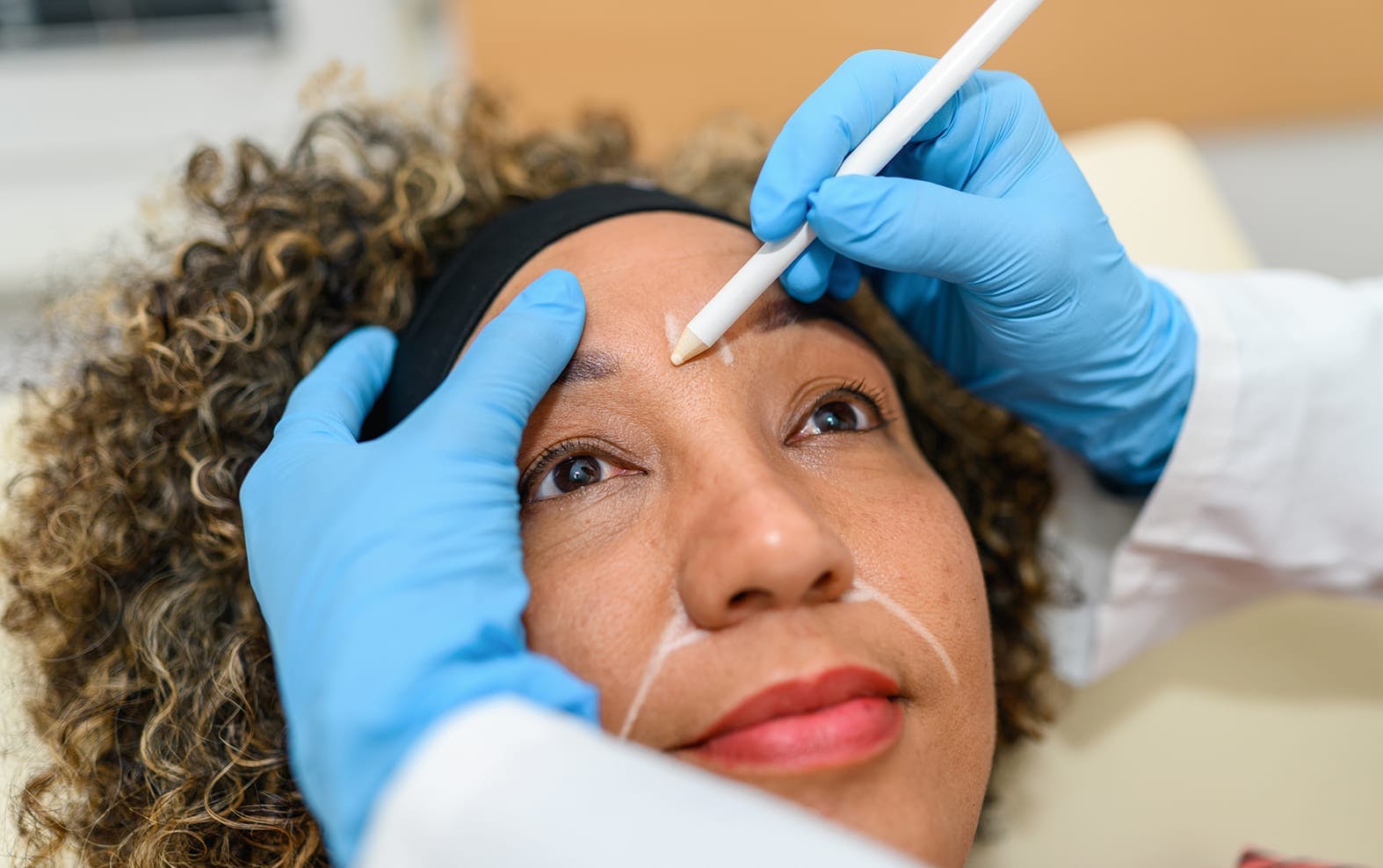 Facelift Scars - Dr. Anil Shah, Facial Plastic Surgeon | Chicago, IL