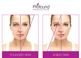 Profound: The Most Advanced Skin Tightening | Blog | Boston Center for ...
