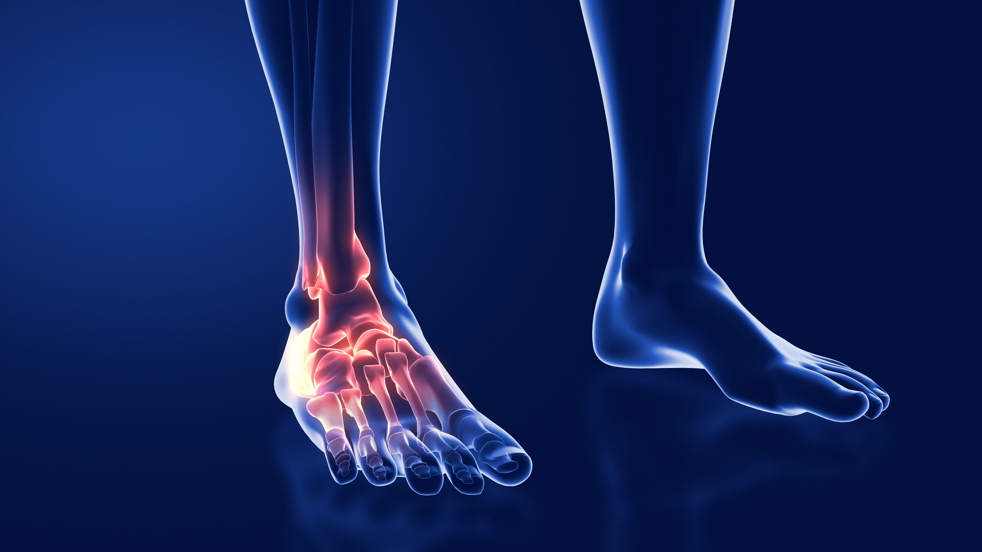 Foot & Ankle Tendon Tear | Premier Orthopaedic Associates
