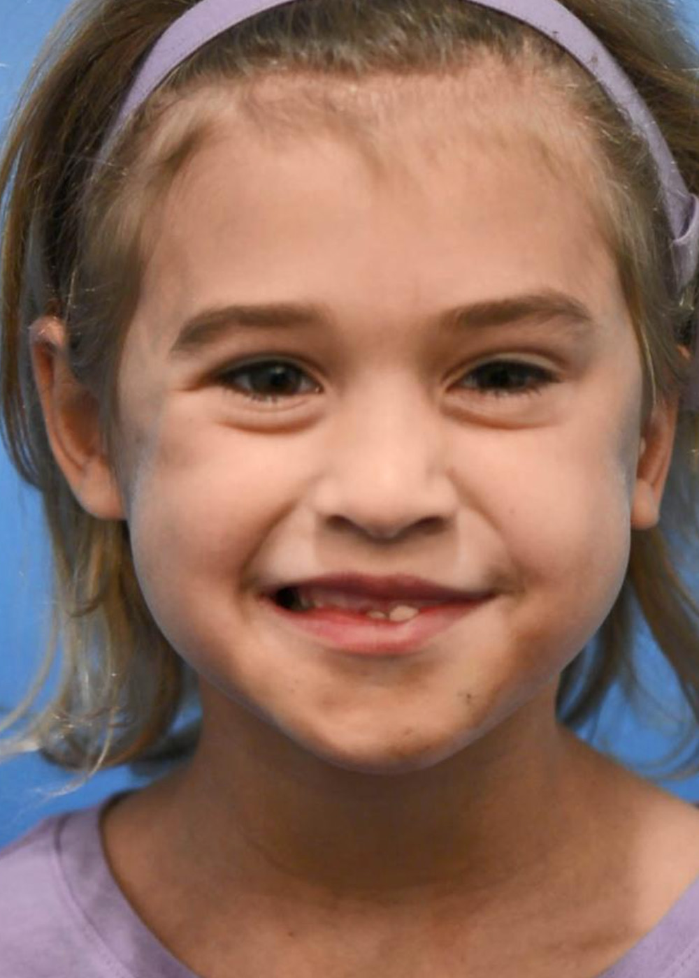 Celebrating Kids | Hadlock Facial Plastic Surgery