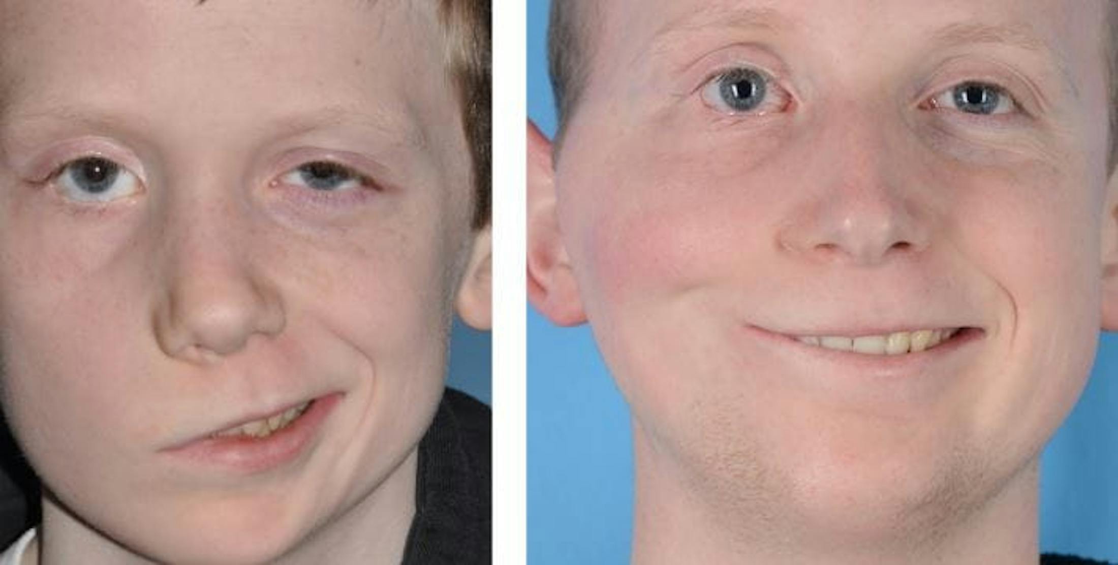 Celebrating Kids | Hadlock Facial Plastic Surgery