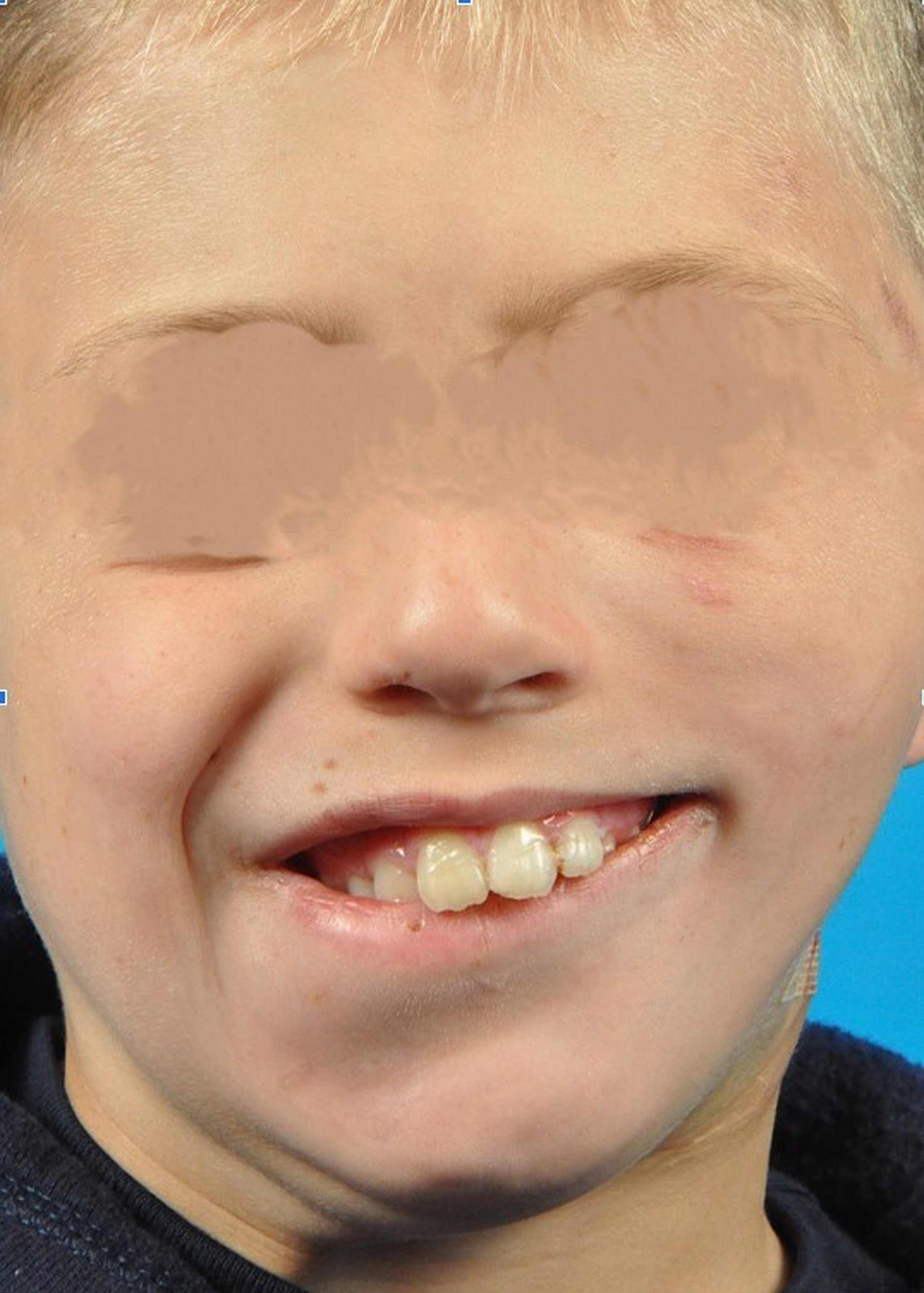 Celebrating Kids | Hadlock Facial Plastic Surgery