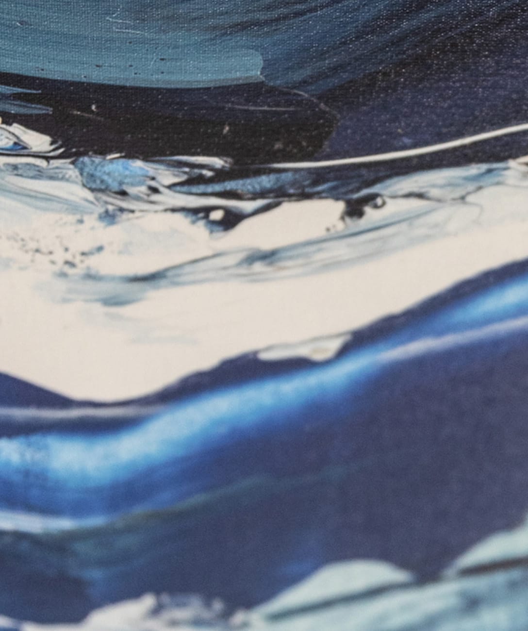 Esophageal Manometry Study | Meliora Healthcare