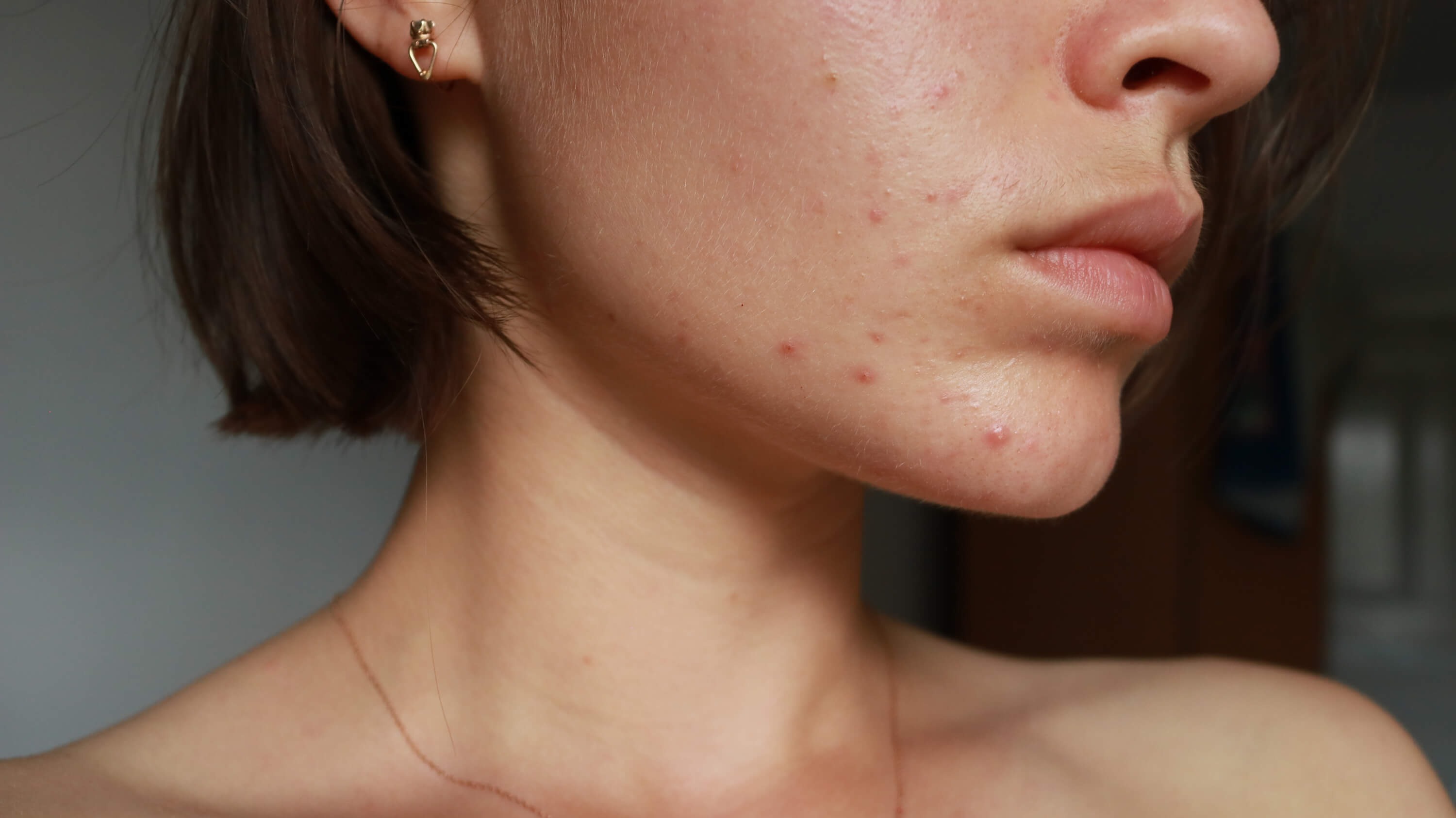 What Your Skin Issues Could Be Telling You About Your Health | Evie ...