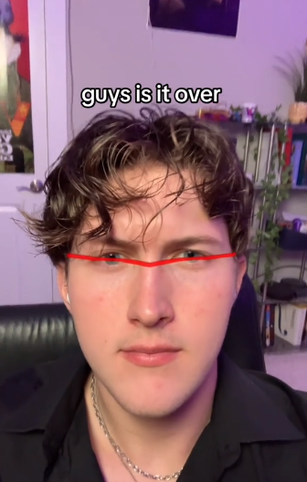 Gen Z Is Concerned About Their Negative Canthal Tilt As "Looksmaxxing ...