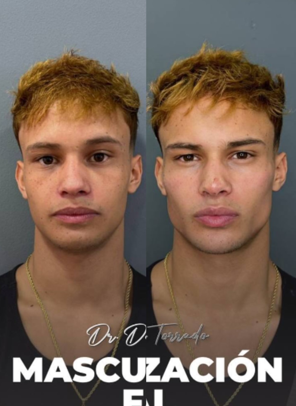 Men Are Getting "Masculinization Facials" To Look More Manly | Evie ...