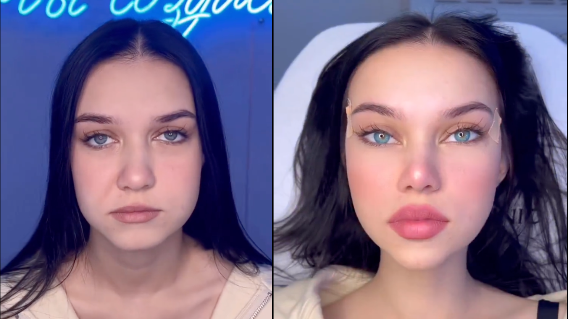 Viral Before-And-After Photo Reveals The Extreme Procedures Women Are ...