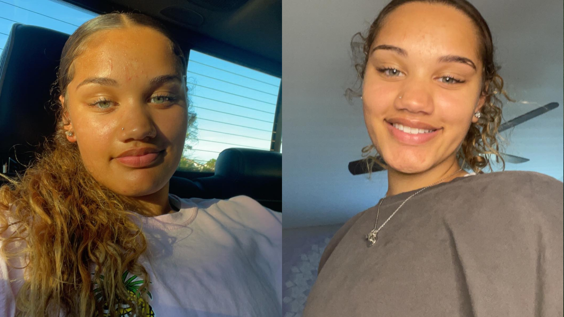 17-Year-Old Janae Edmonson Lost Her Legs And College Volleyball Career ...