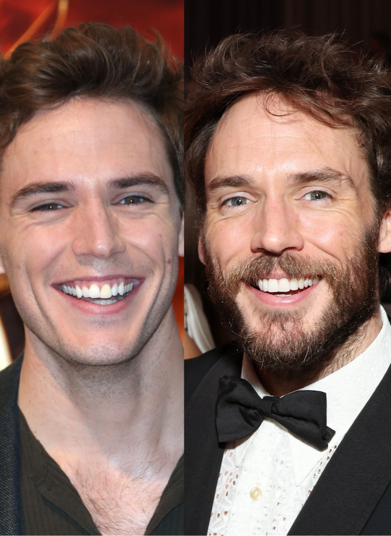 Did Sam Claflin Get Veneers? Here Are 14 Celebrities Before And After ...