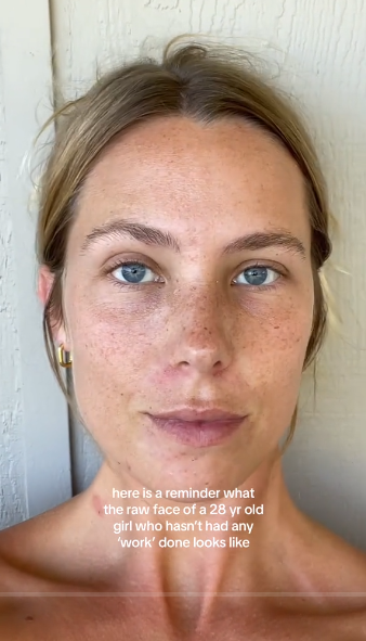 Women Show Off Their Real Skin In "No Filter" Trend | Evie Magazine