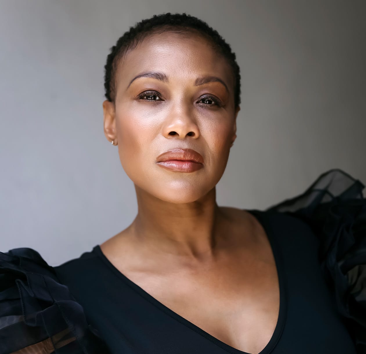 Neck Lift in Seattle, Bellevue, & Kirkland | Yarrow Bay Plastic Surgery