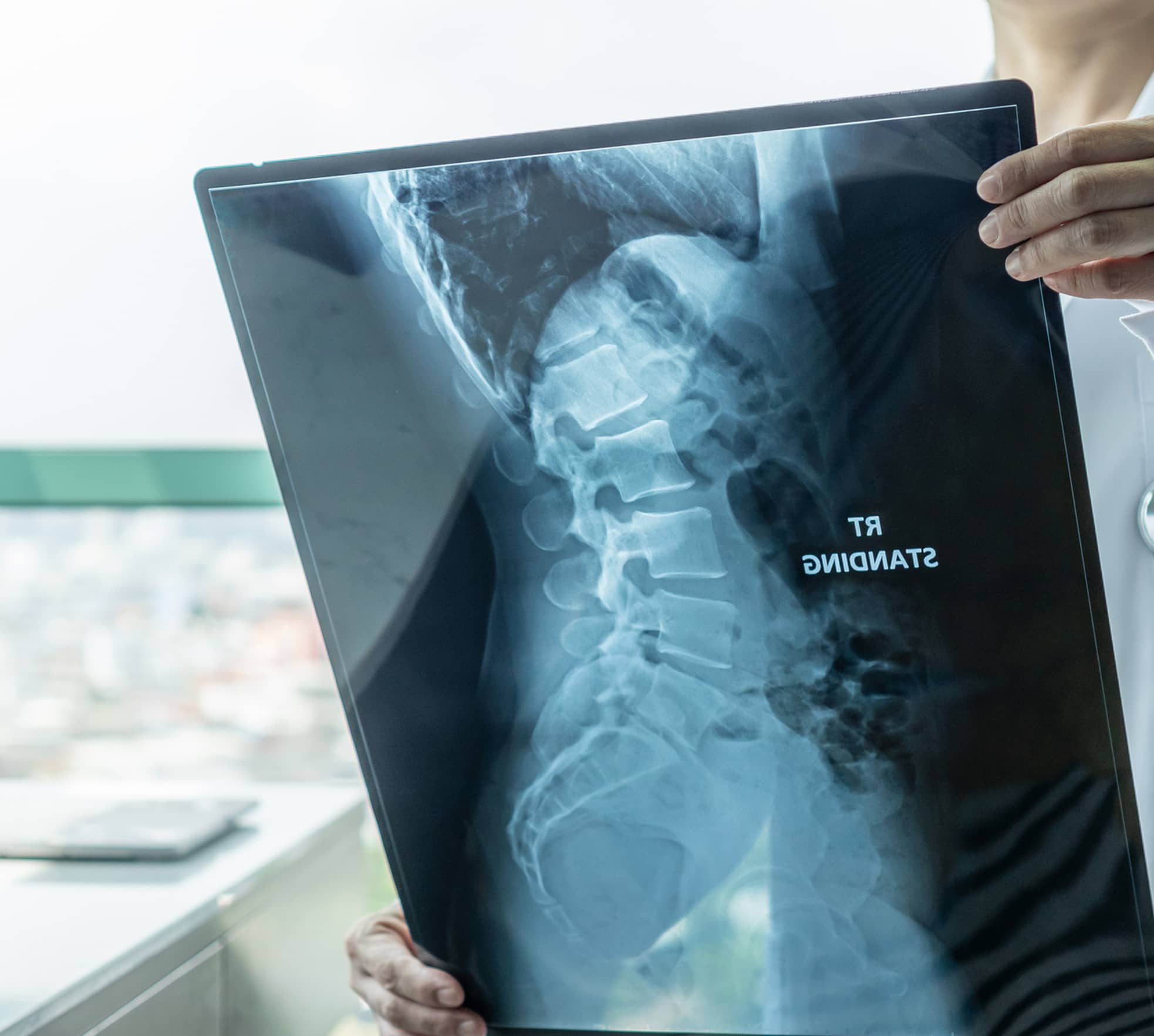 Disc Replacement - Shrewsbury, NJ & Toms River, NJ: Center for the ...