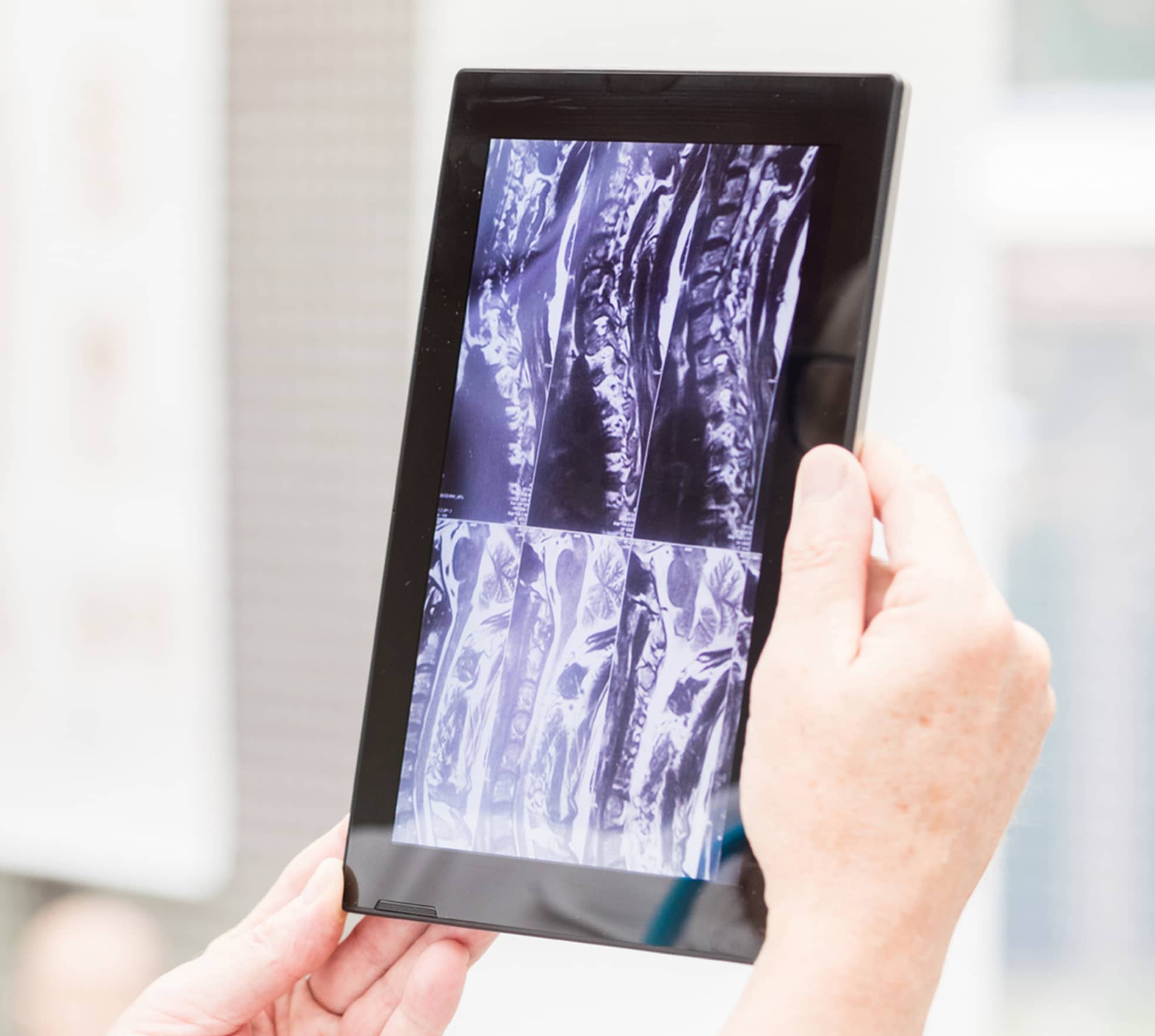 Discogram | Center for the Functional Restoration of the Spine