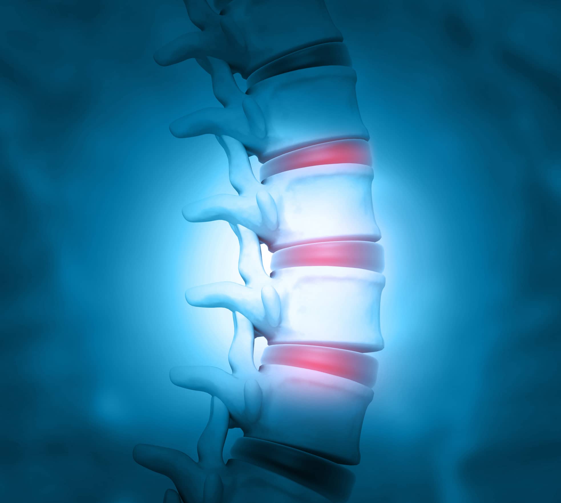 Microdisectomy - Shrewsbury, NJ & Toms River, NJ: Center for the ...