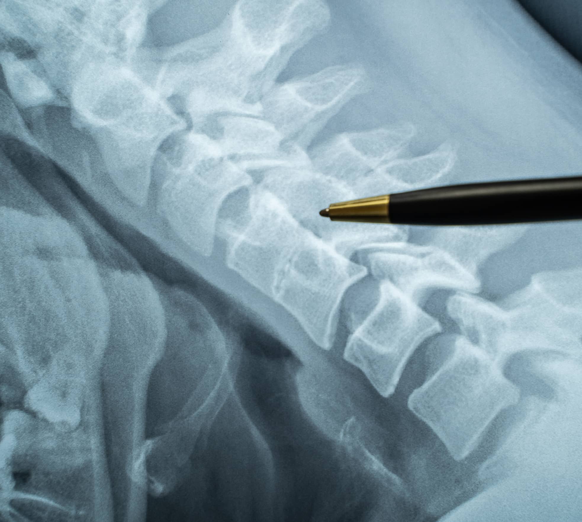 Pain Management Injections Shrewsbury | Pain Management in Edison, NJ