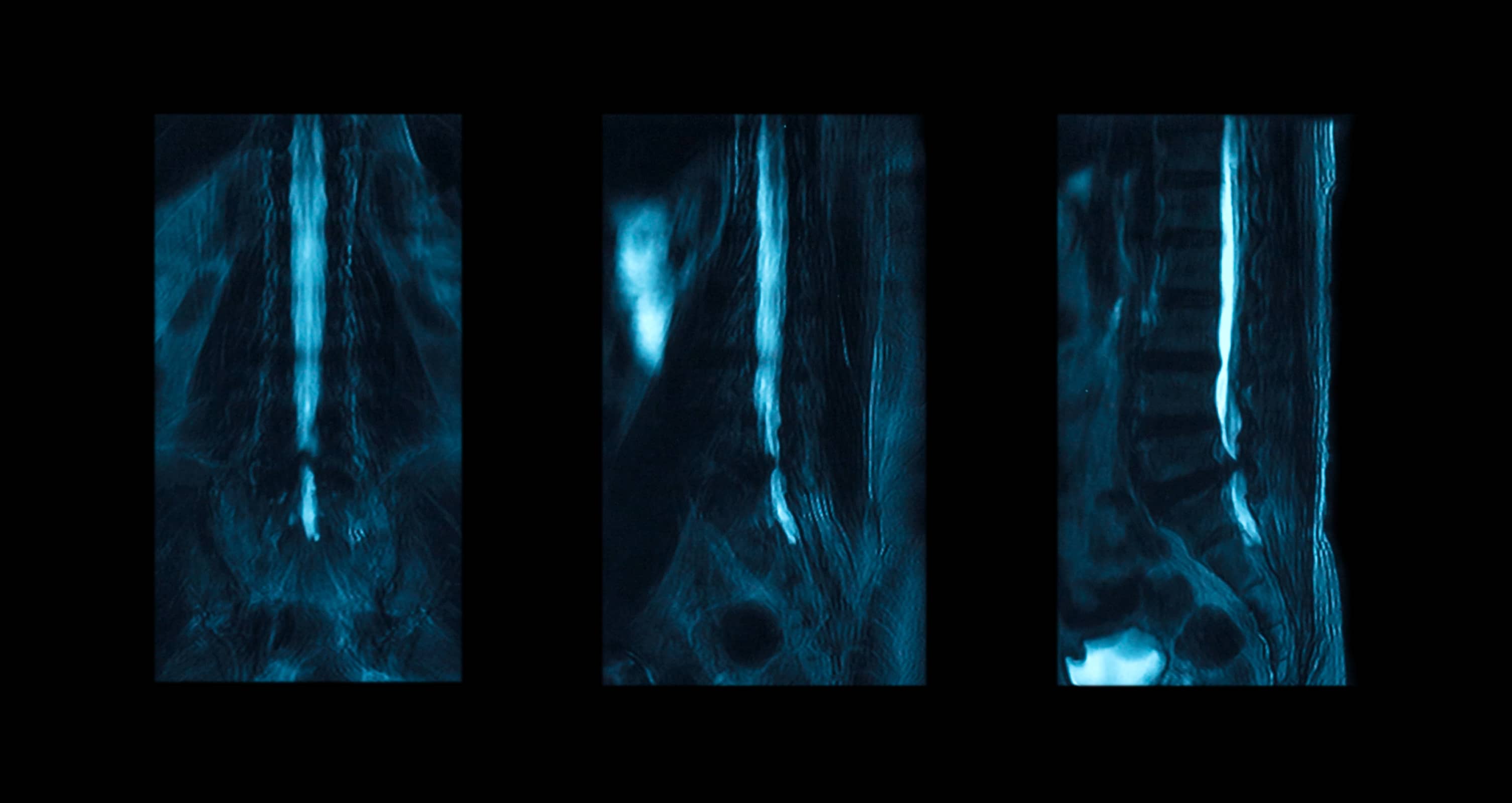 Diagnostics | Center for the Functional Restoration of the Spine