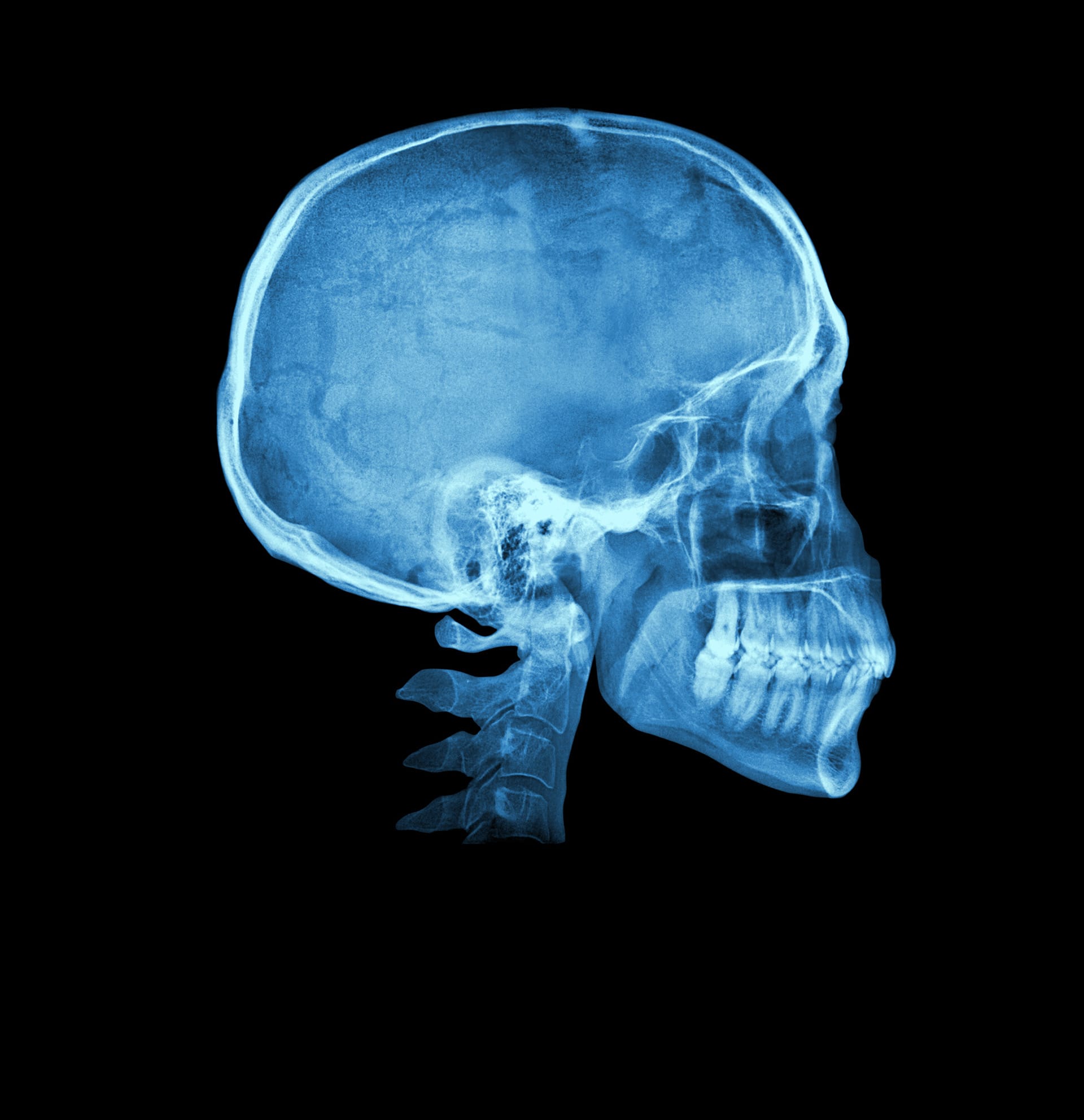 Craniofacial Surgery in West Palm Beach | Palm Beach Plastic Surgery ...