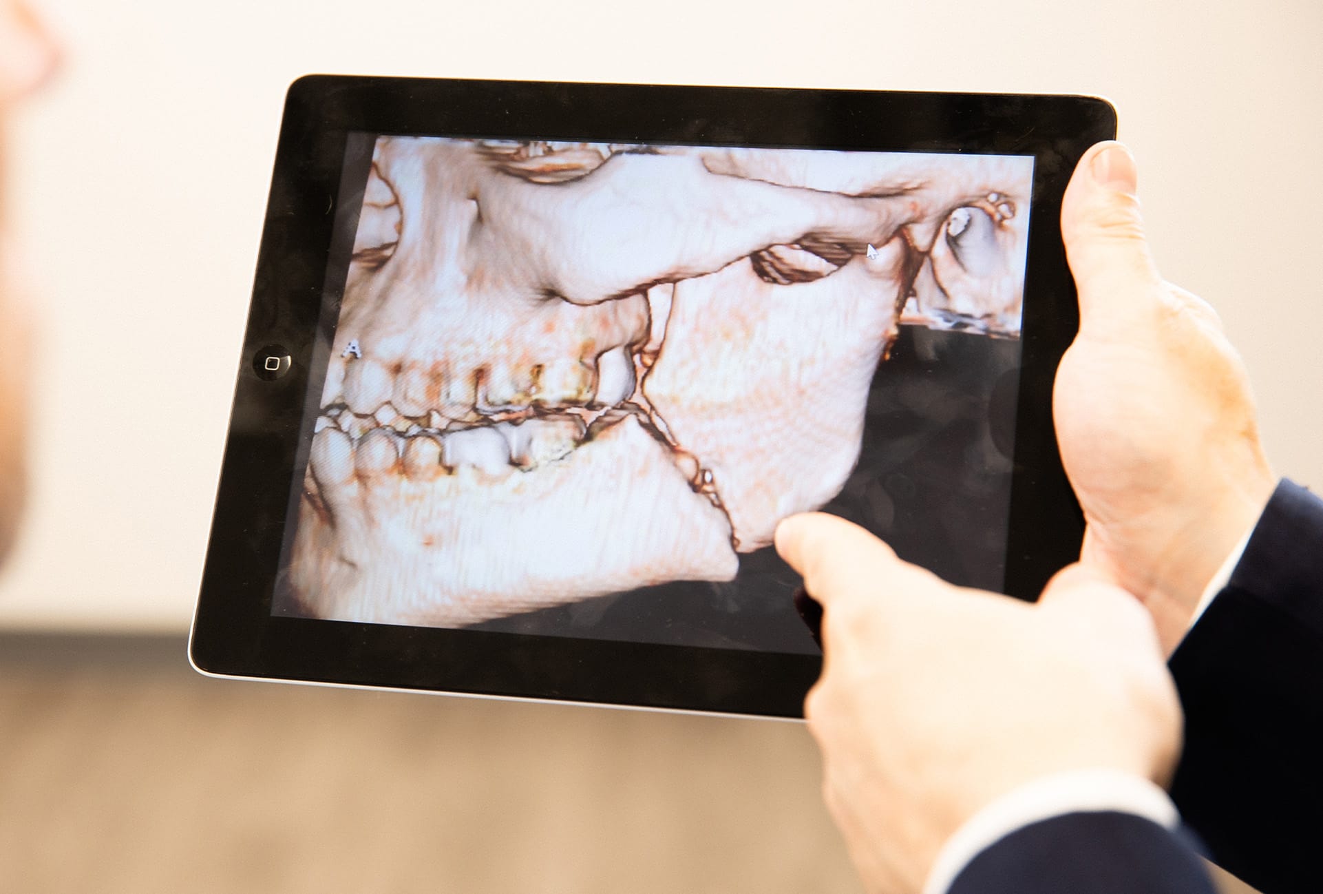 Facial Fracture Repair in West Palm Beach | Palm Beach Plastic Surgery ...