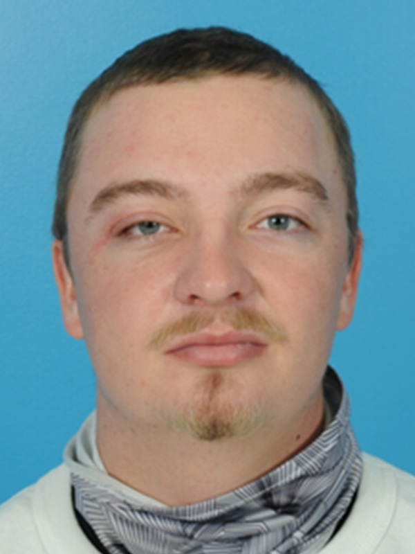 Patient 320415 | Facial Trauma Repair Before & After Photos | Palm ...