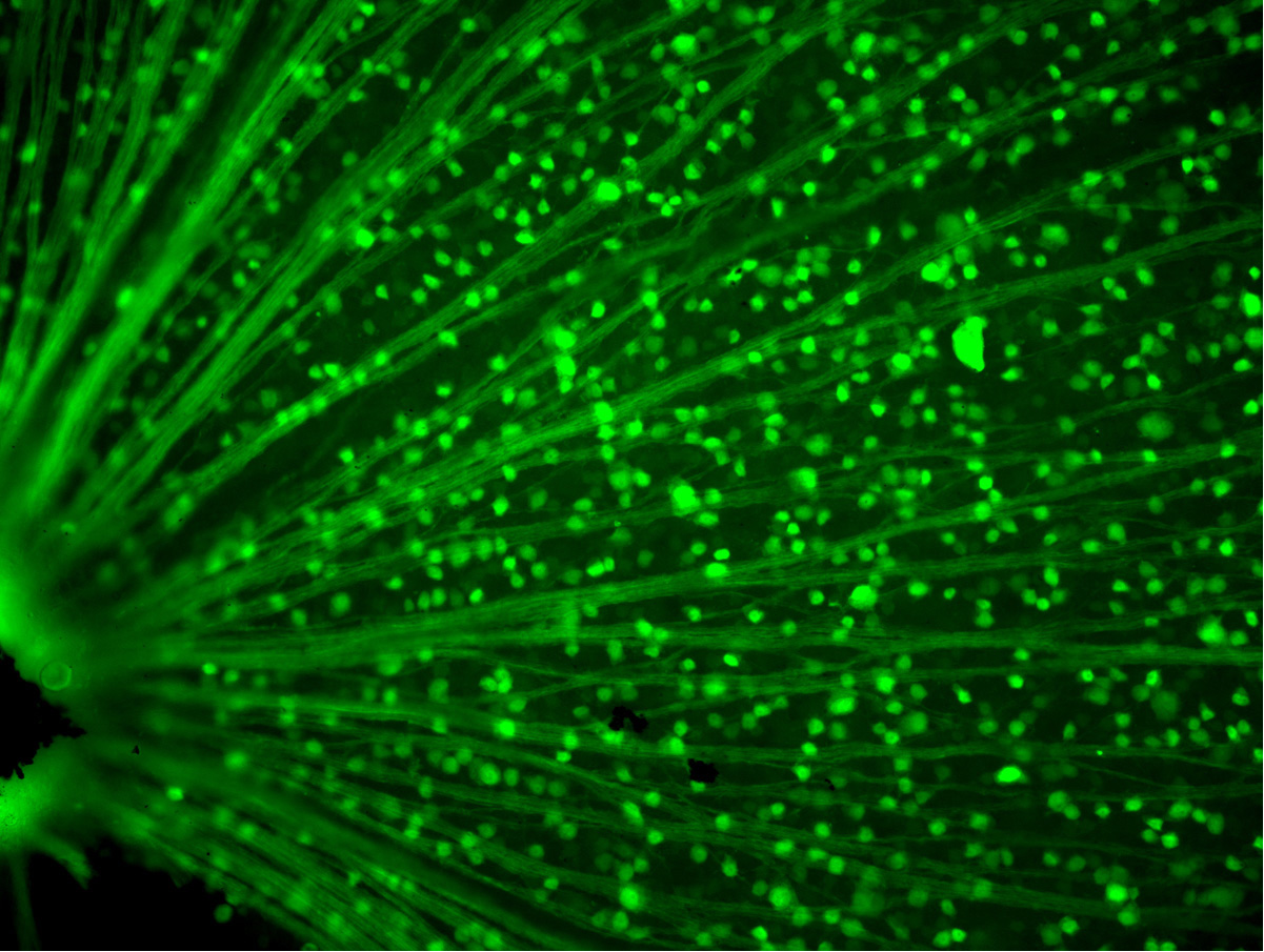 Snow Medical | Snow Vision Accelerator