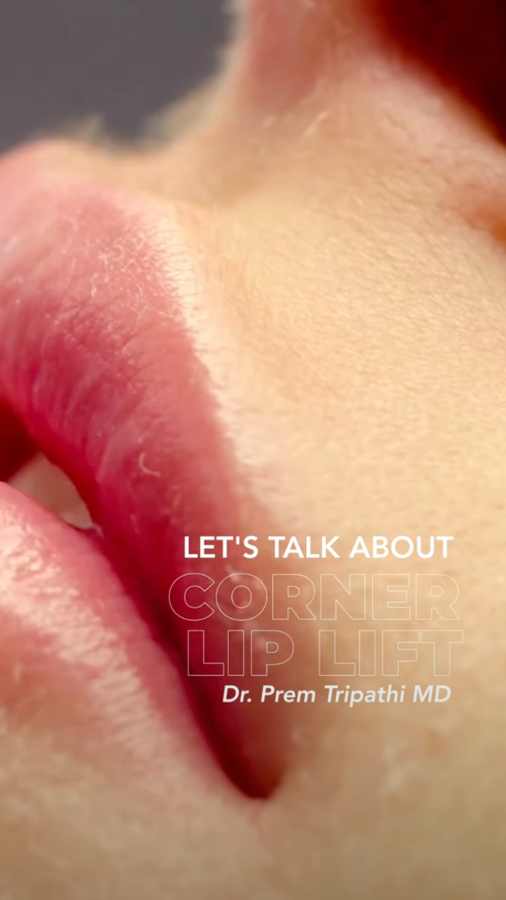 Lip Lift in Danville | Bay Hills Plastic Surgery