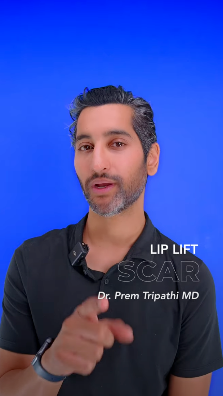 Lip Lift In Danville Bay Hills Plastic Surgery