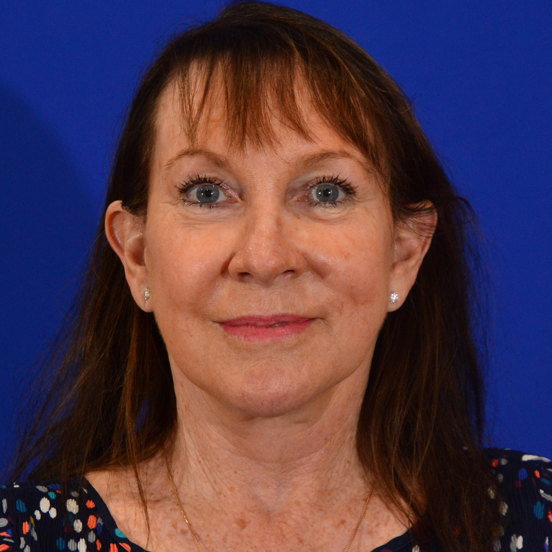 Patient 712813 | Facelift & Necklift Before & After Photos | Dr ...