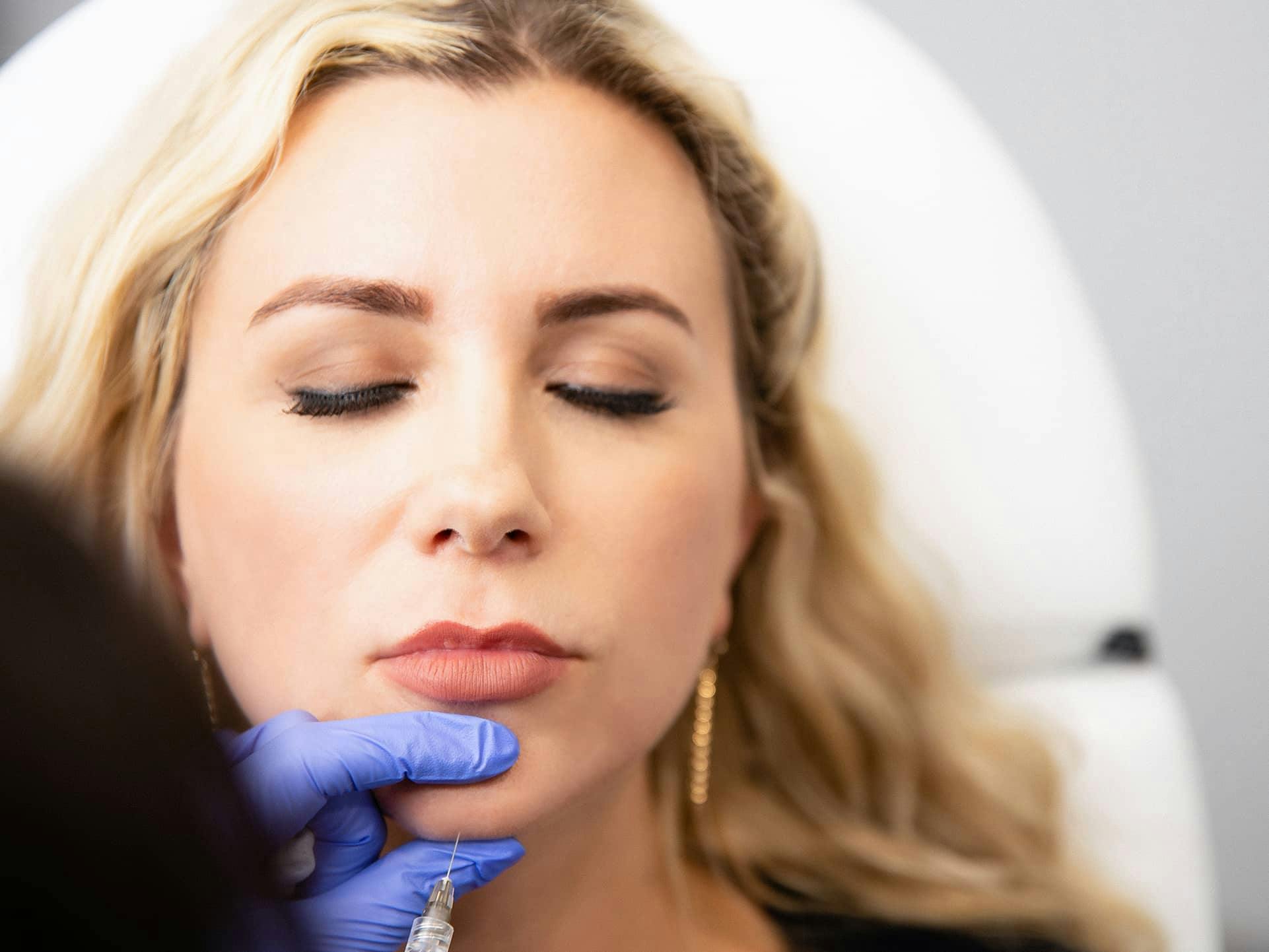 Dermal Fillers in Chicago, IL | Concierge Aesthetics & Plastic Surgery Dermal Fillers in Chicago, IL | Concierge Aesthetics & Plastic Surgery
