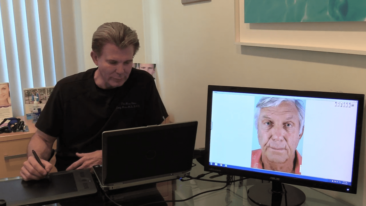 Best Facelift in San Francisco | The Maas Clinic™