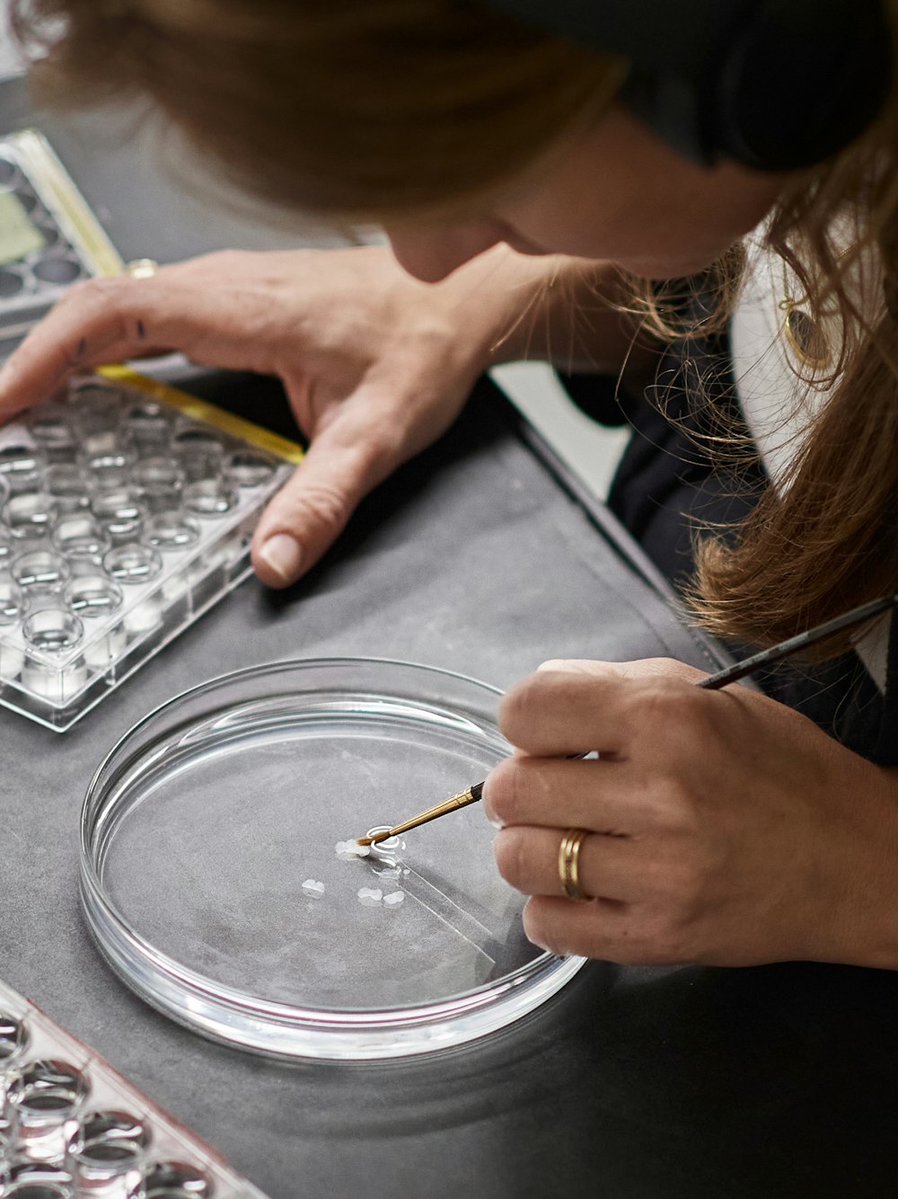 Experimental Imaging & Neuroenergetics – Bruno Weber Lab