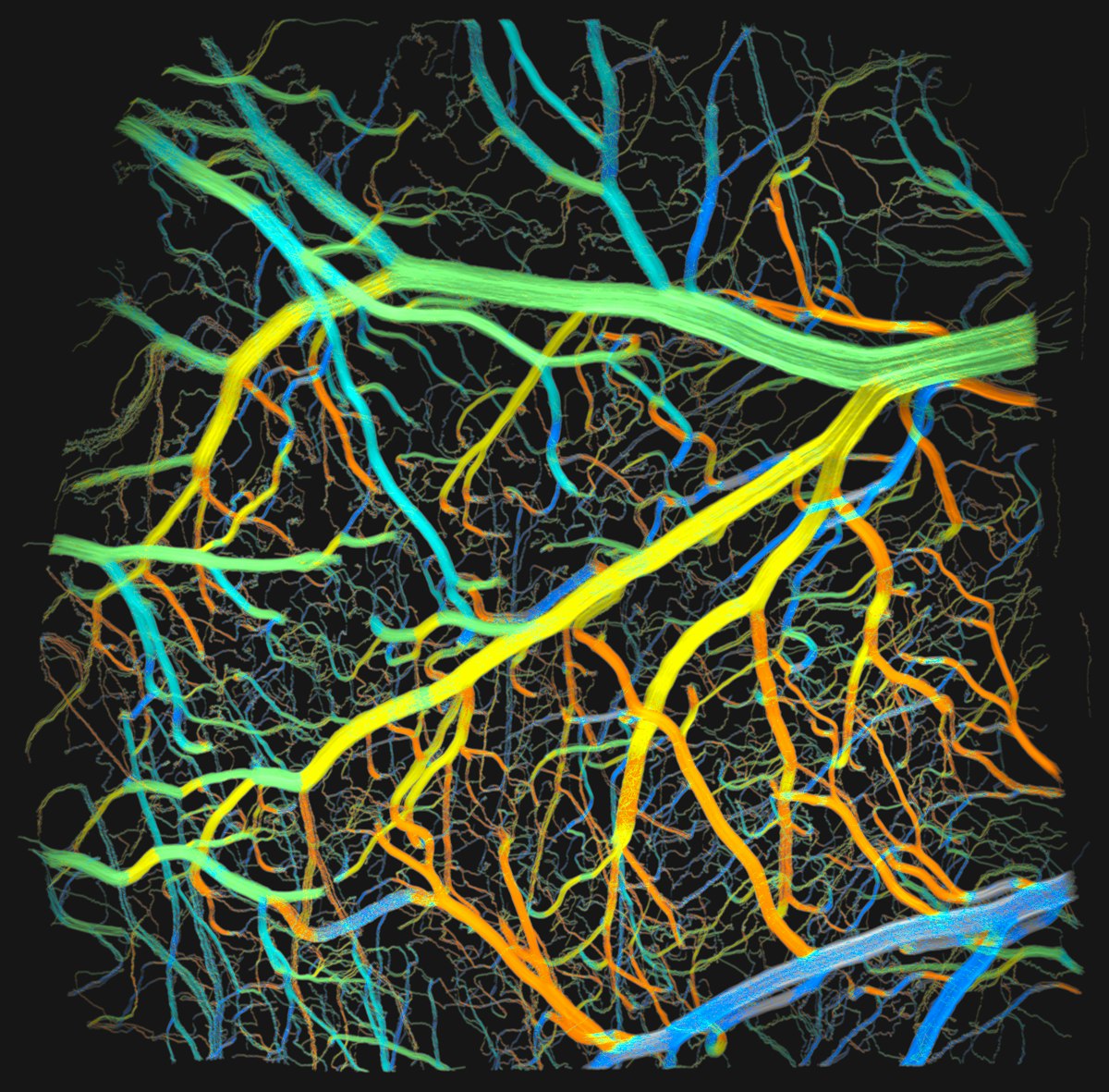 Pia-FLOW: Deciphering hemodynamic maps of the pial vascular connectome ...
